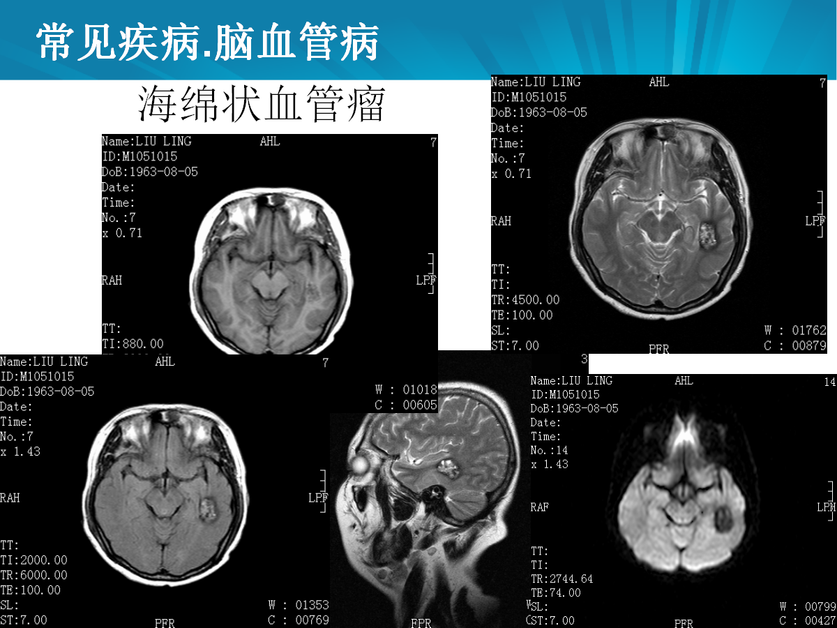 手把手教你如何阅读MRI片，太实用了！ - 好医术早读文章 - 好医术-赋能医生守护生命